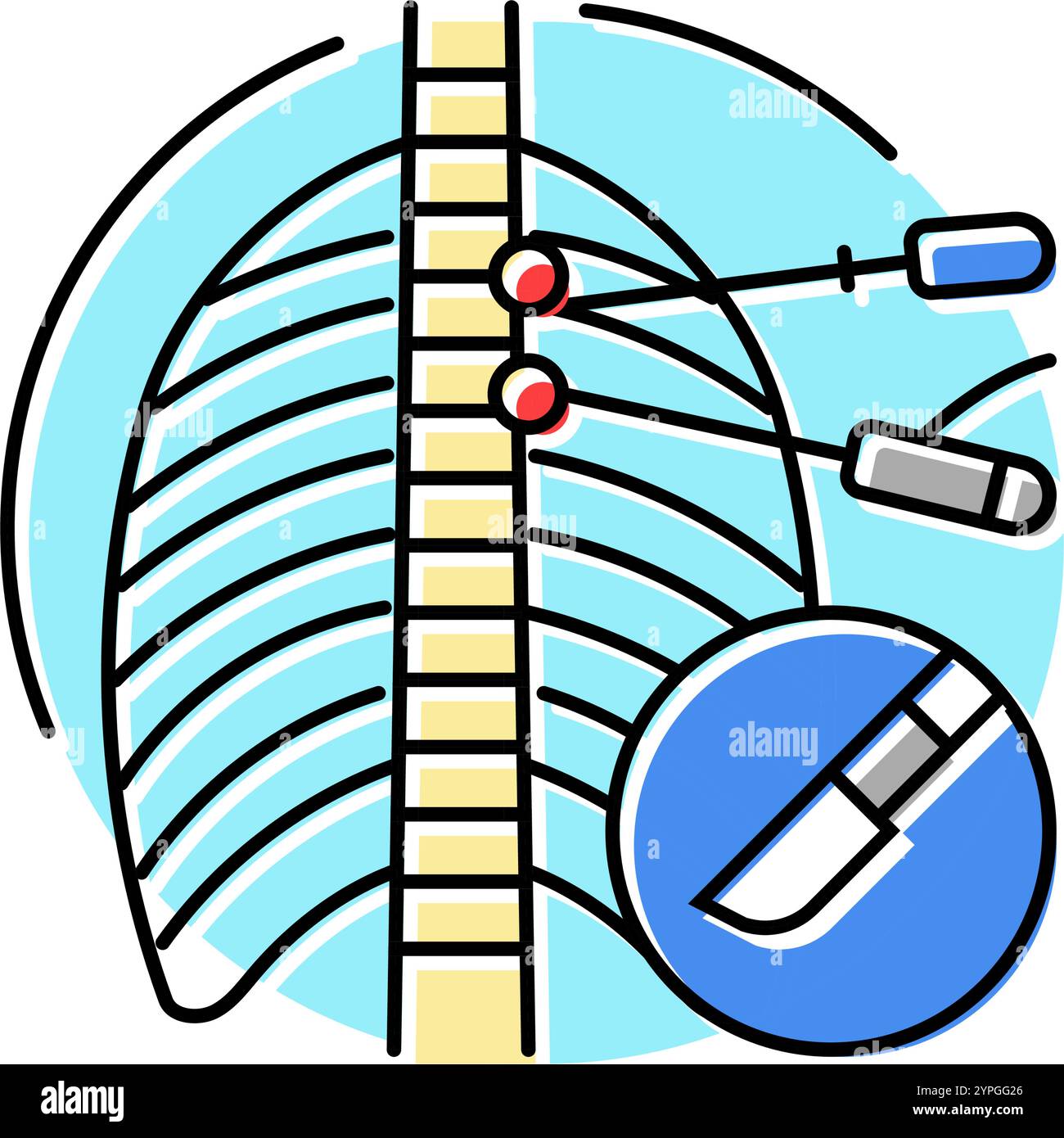 Sternotomy hi-res stock photography and images - Alamy