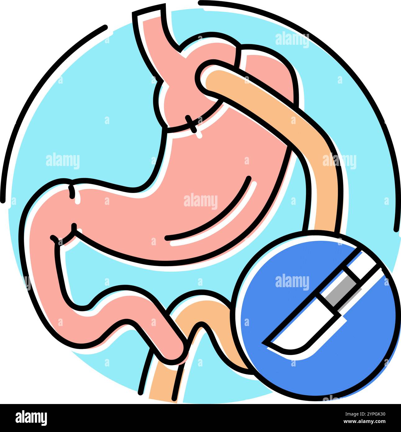 gastric bypass surgery color icon vector illustration Stock Vector ...