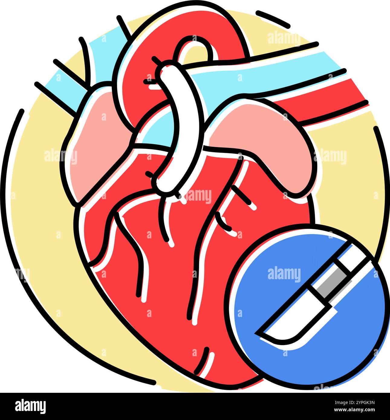 heart bypass surgery color icon vector illustration Stock Vector Image ...