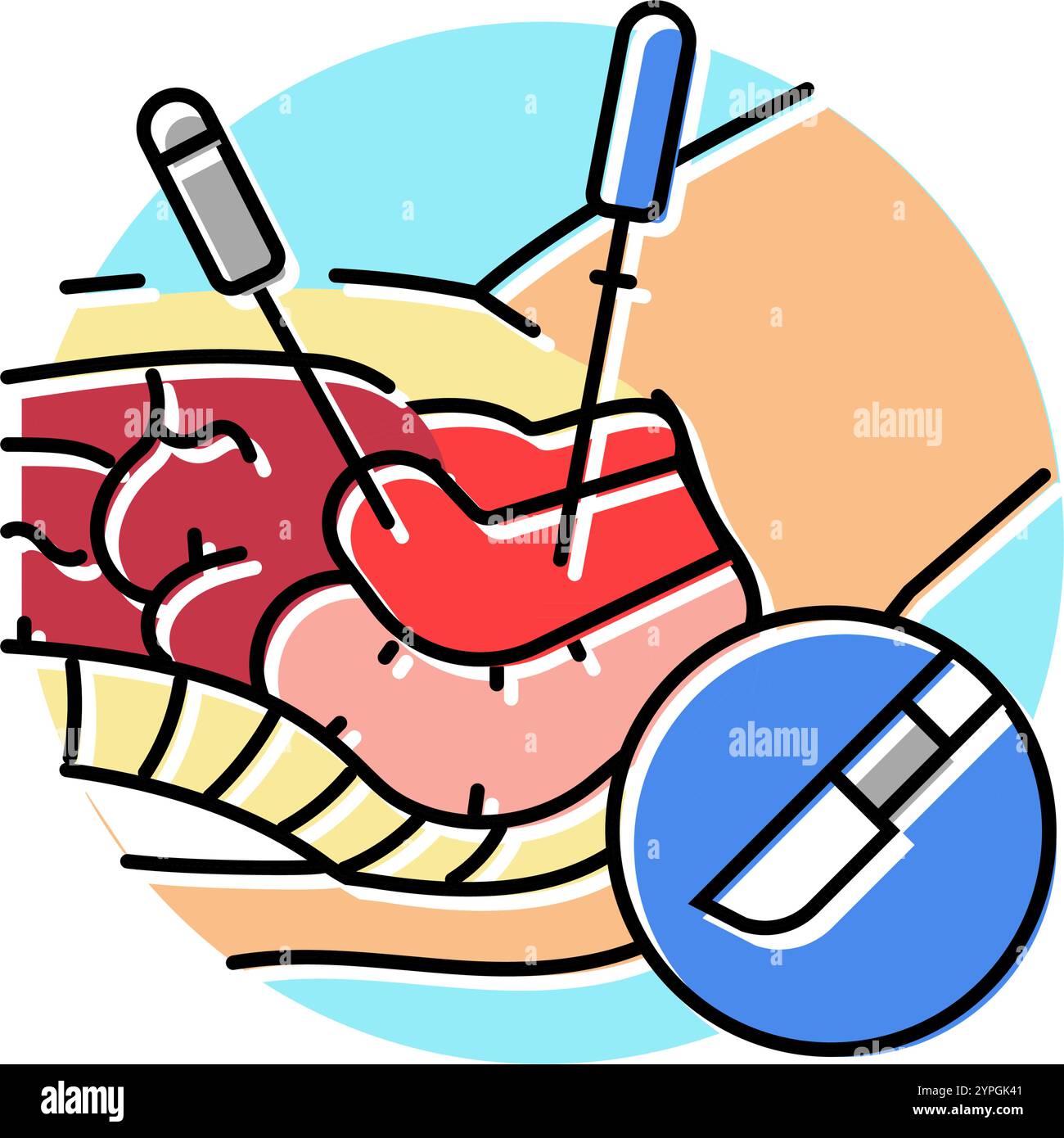 gynecologic laparoscopy color icon vector illustration Stock Vector ...