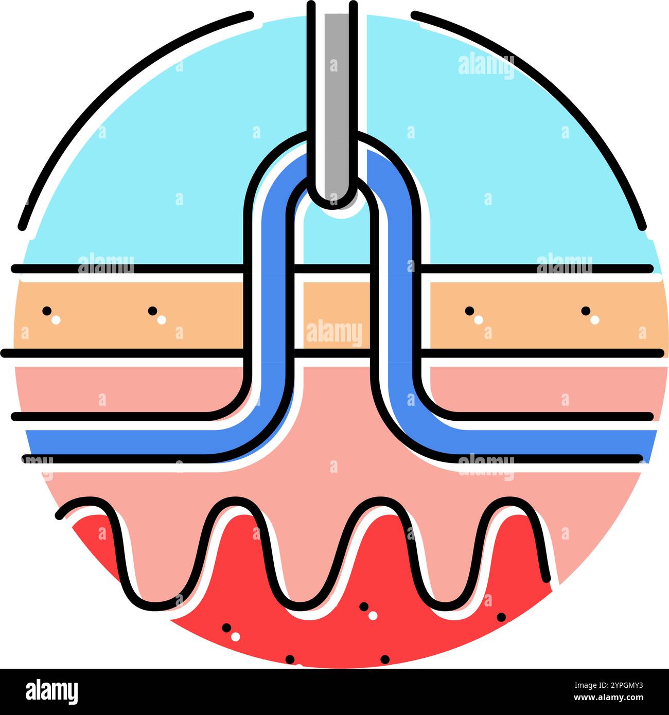 percutaneous nephrolithotomy color icon vector illustration Stock ...