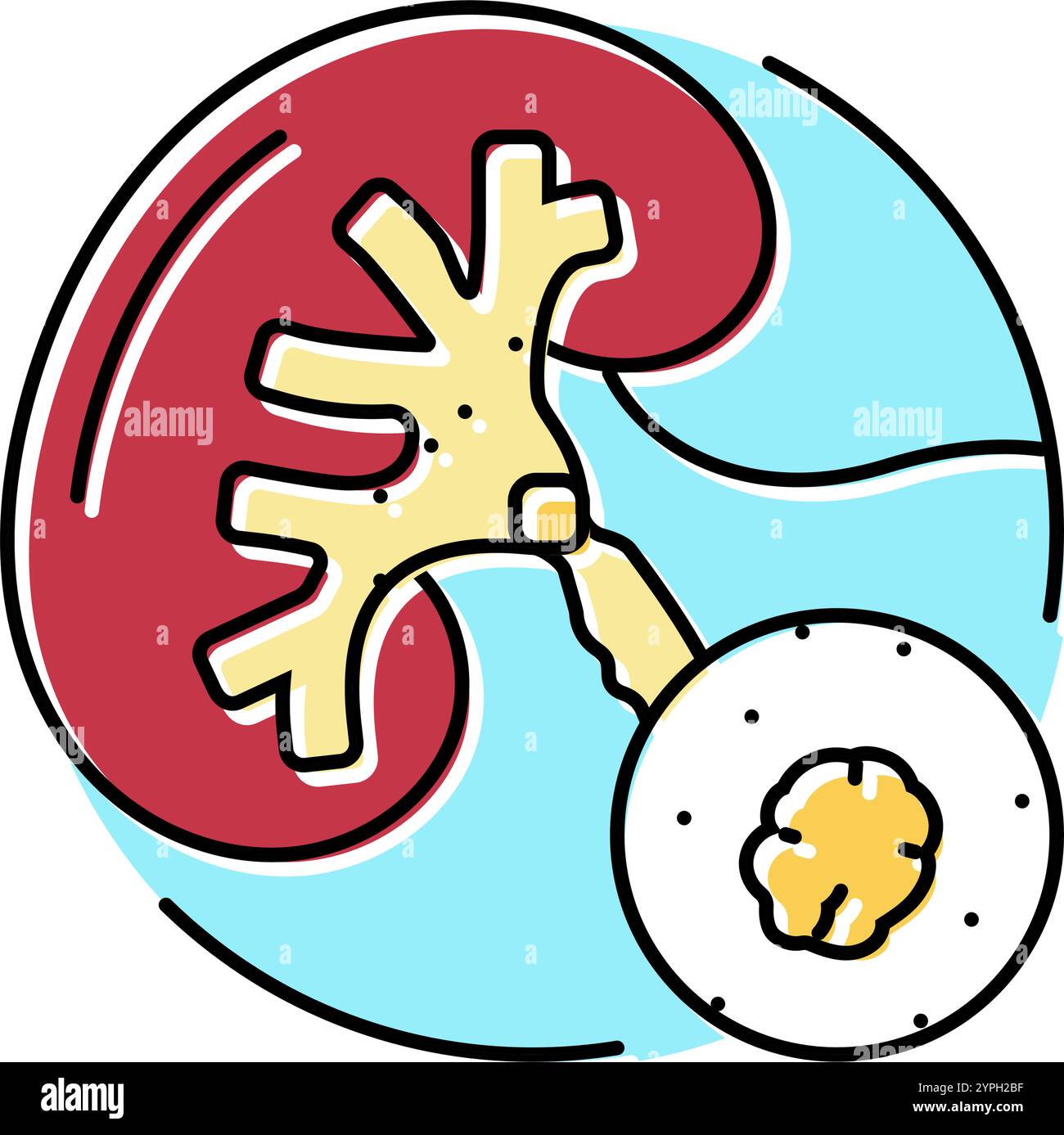 urolithiasis urology color icon vector illustration Stock Vector Image ...