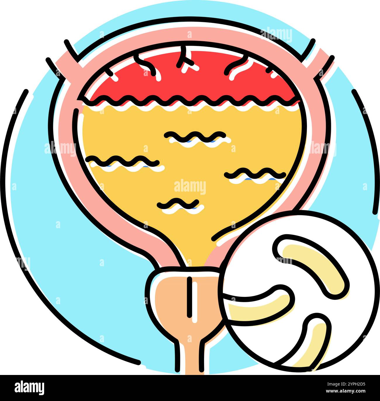 cystitis urology color icon vector illustration Stock Vector Image ...
