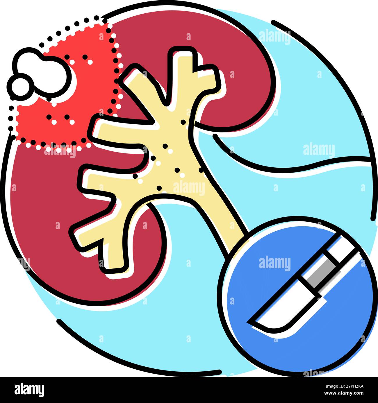 Urostomy system hi-res stock photography and images - Alamy