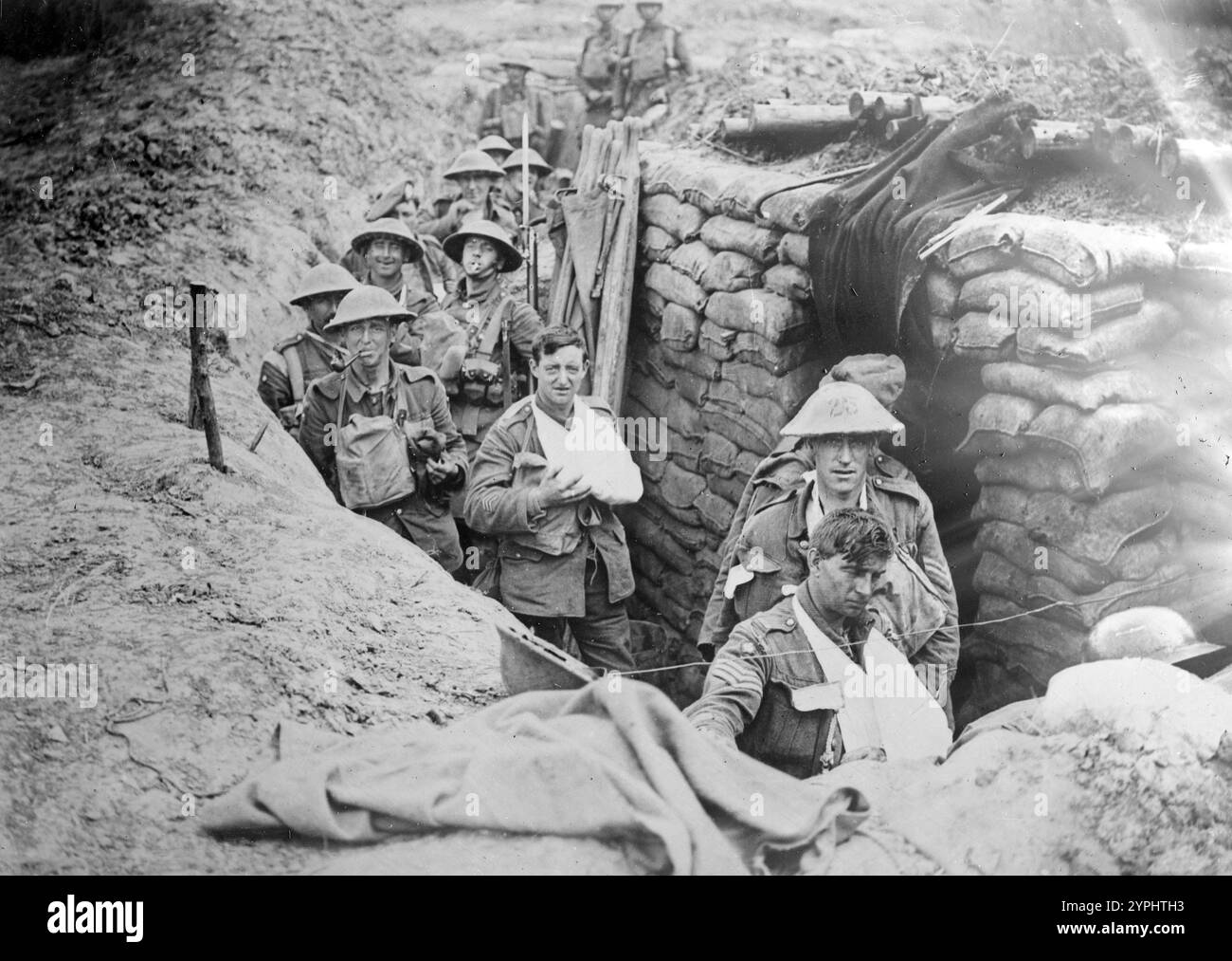Wounded British in trench, wounded British soldiers of the 27th Brigade ...