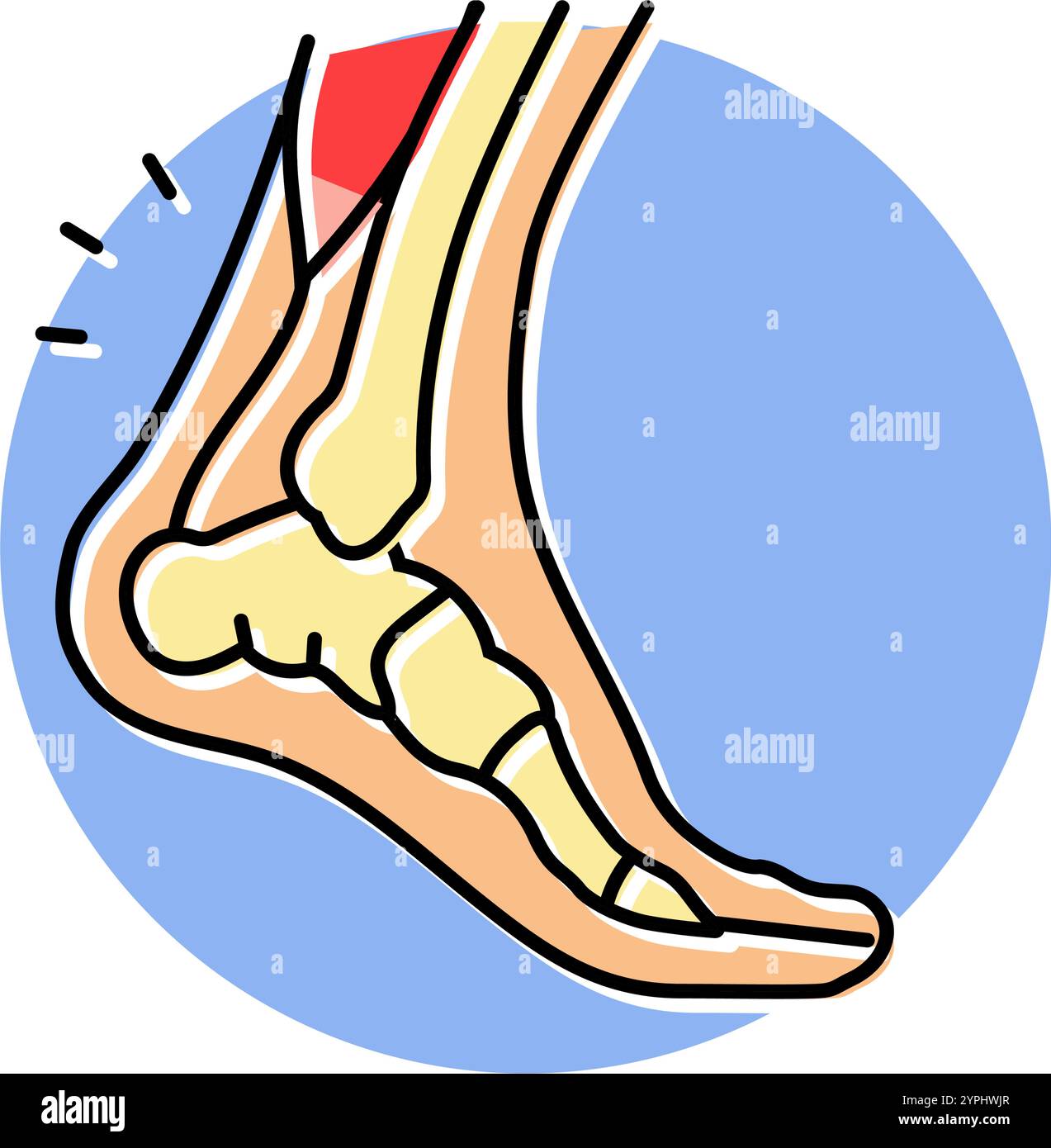 sprain household injury accident color icon vector illustration Stock ...