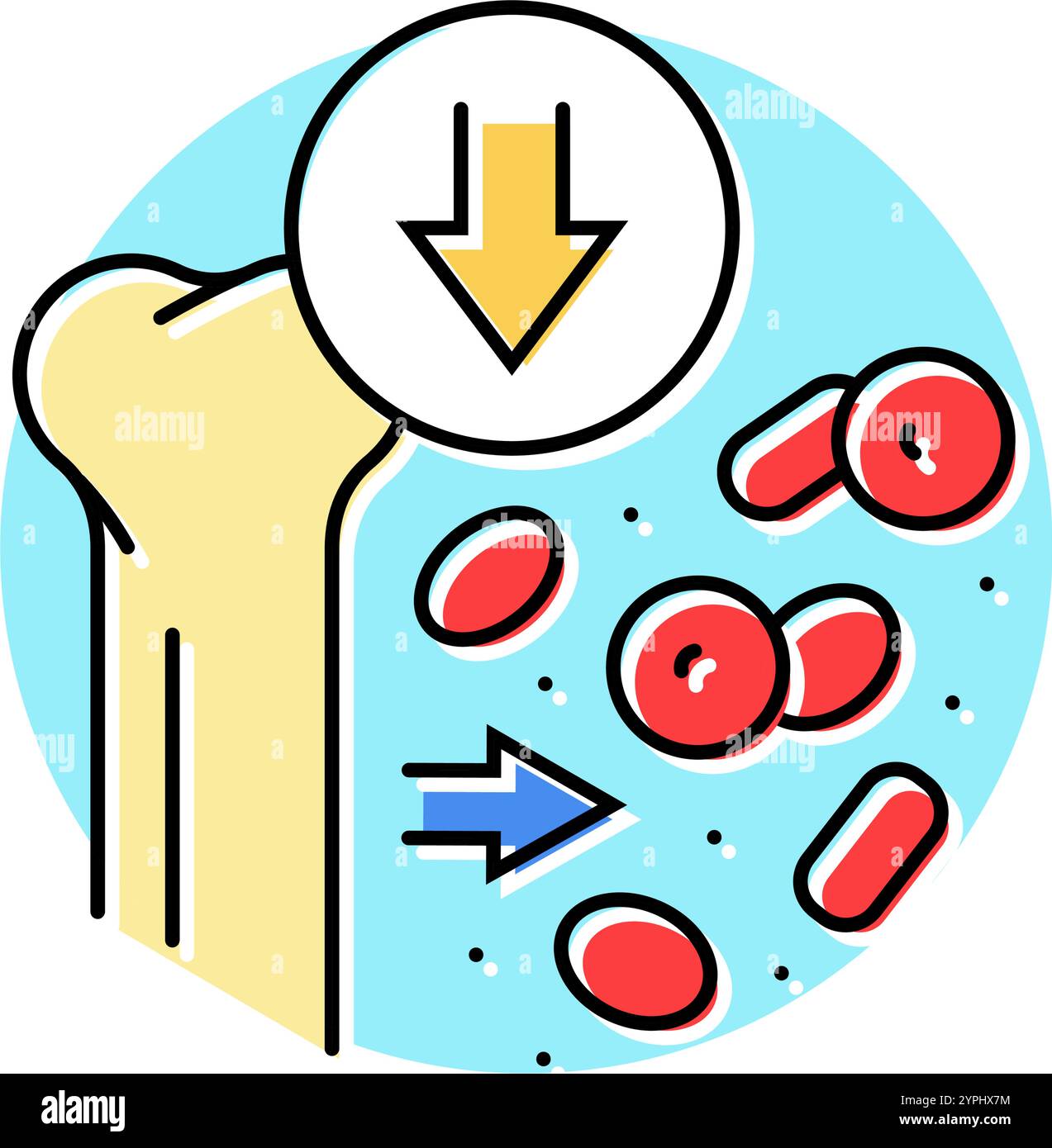 aplastic anemia disease color icon vector illustration Stock Vector ...