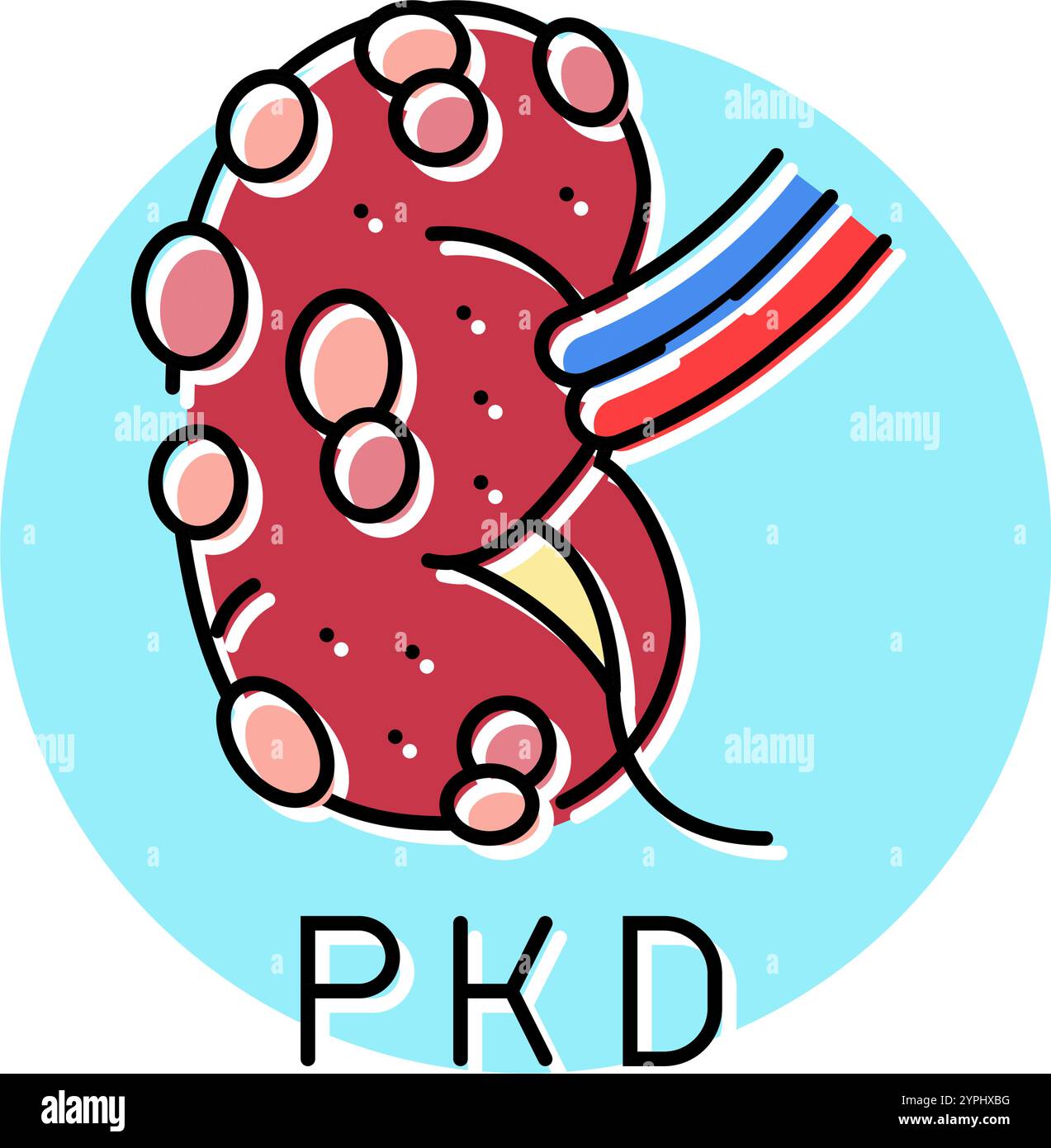polycystic kidney disease color icon vector illustration Stock Vector ...
