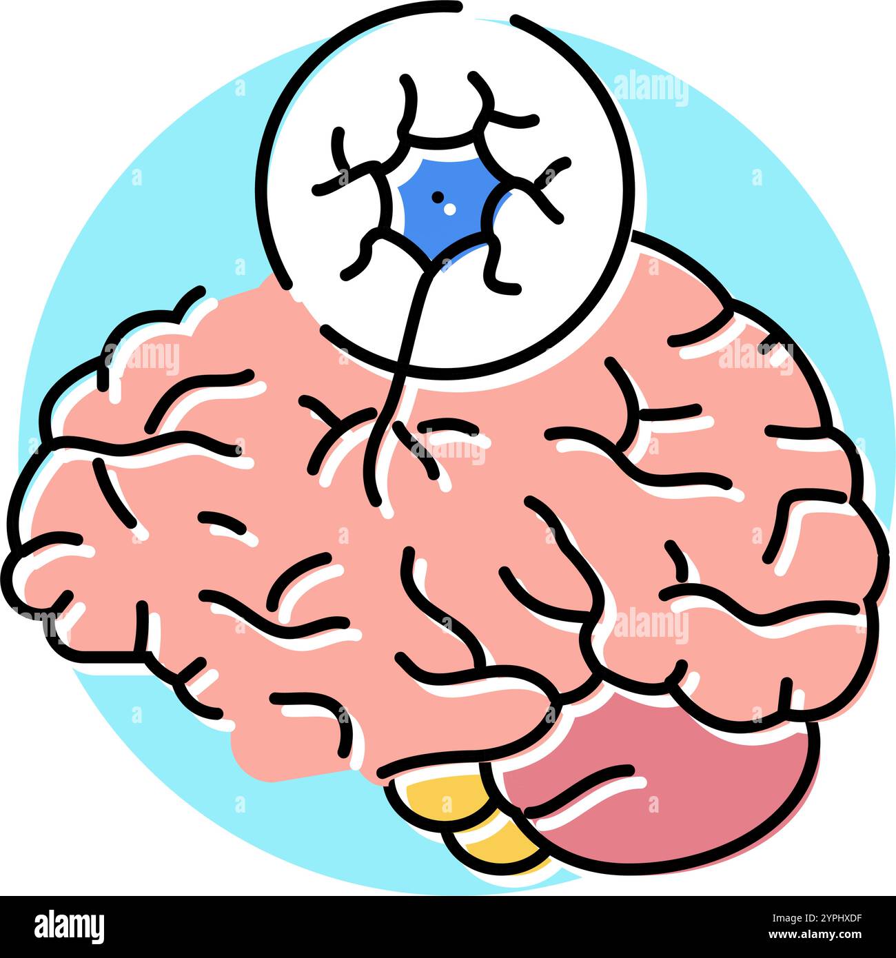 tay sachs disease color icon vector illustration Stock Vector Image ...