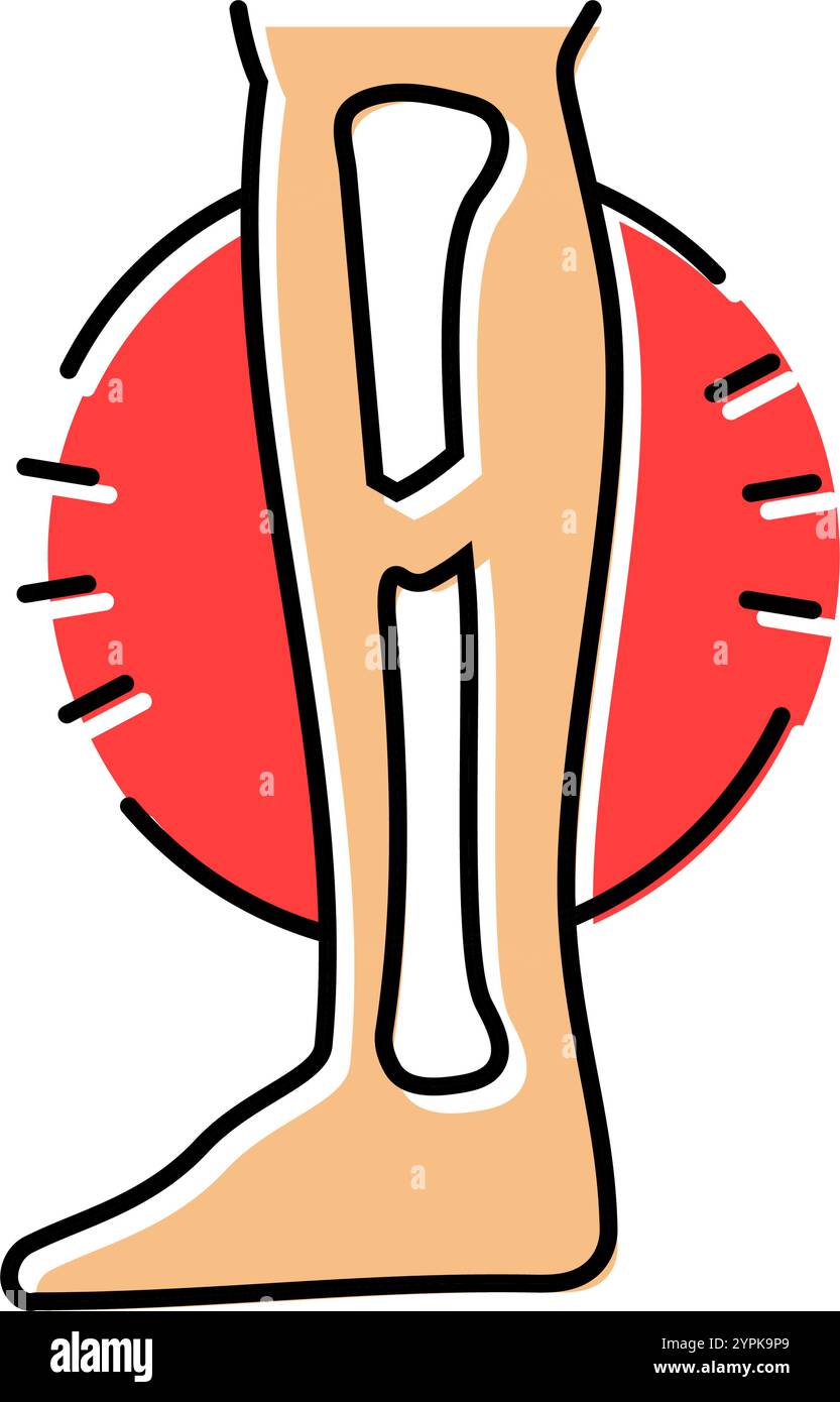 broken leg fracture injury color icon vector illustration Stock Vector ...