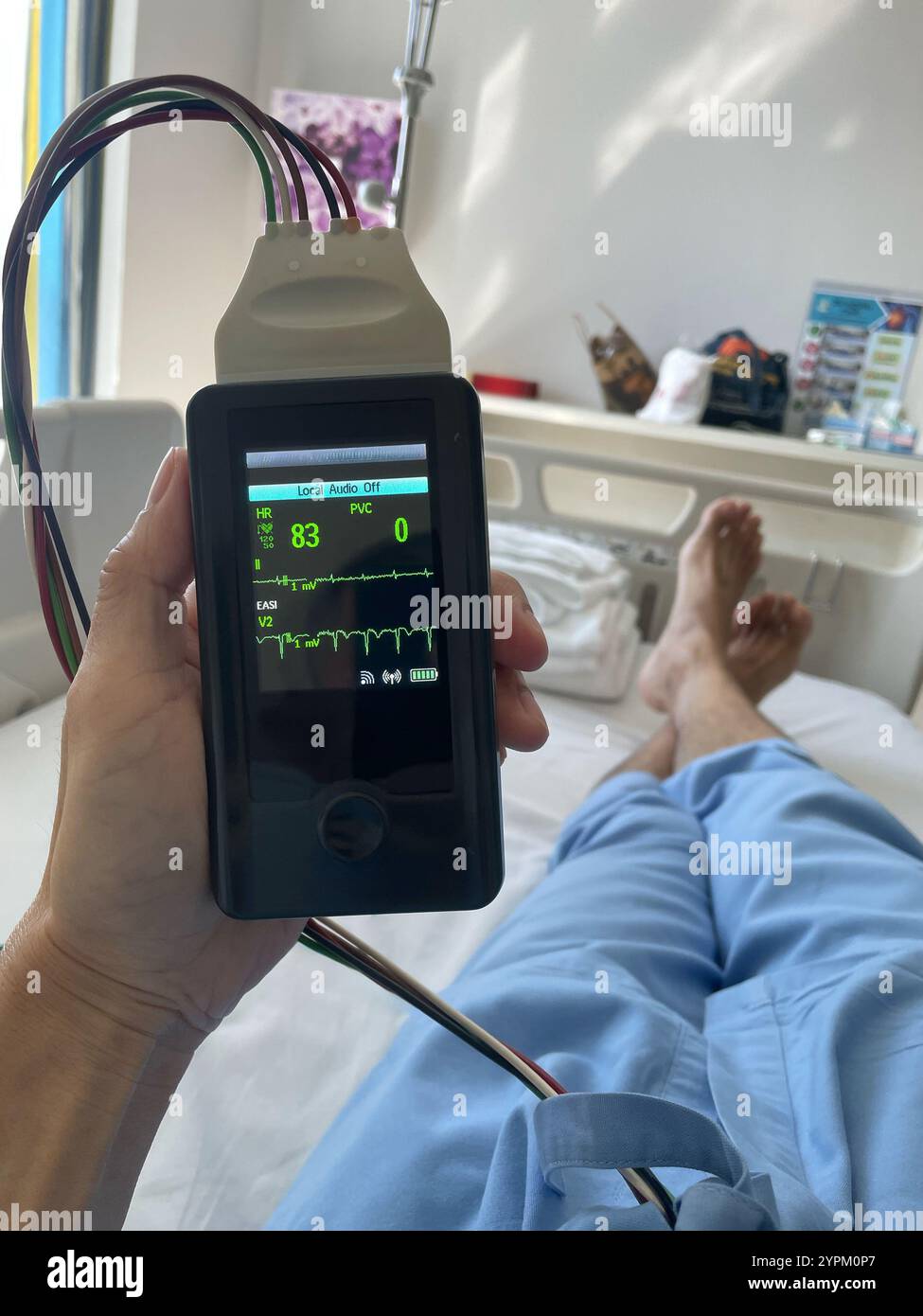 A close-up view of a portable ECG monitor displaying heart rate and ...