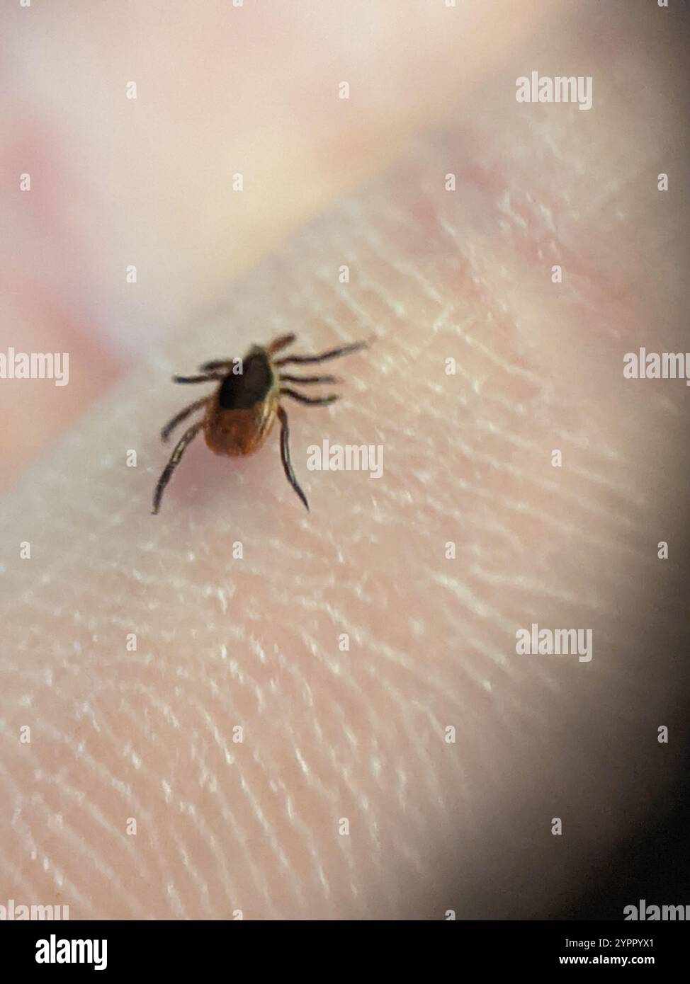 Eastern Black-legged Tick (Ixodes scapularis Stock Photo - Alamy