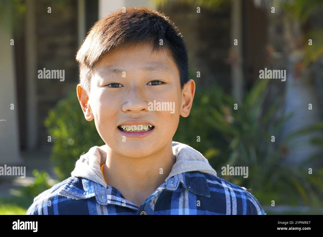 Portrait of young Asian boy with tooth braces. Young teen boy smiling ...