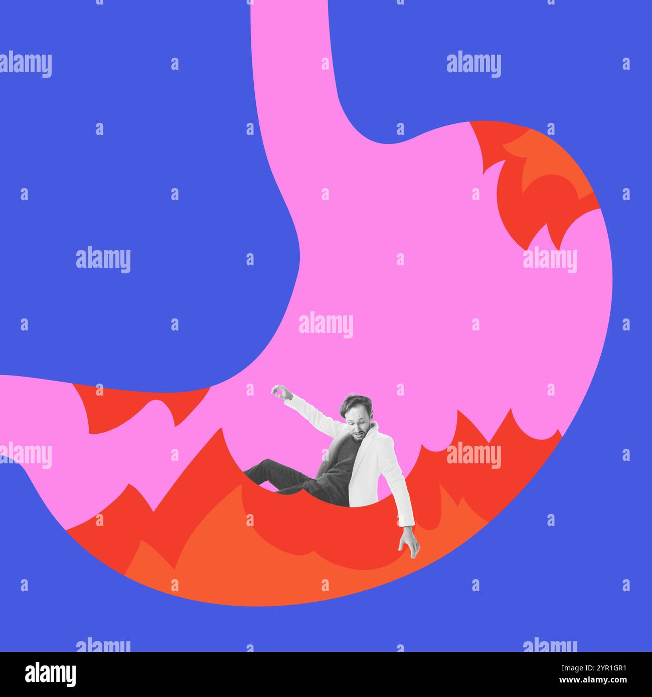 Contemporary art collage. Man in white coat caught in fiery stomach ...
