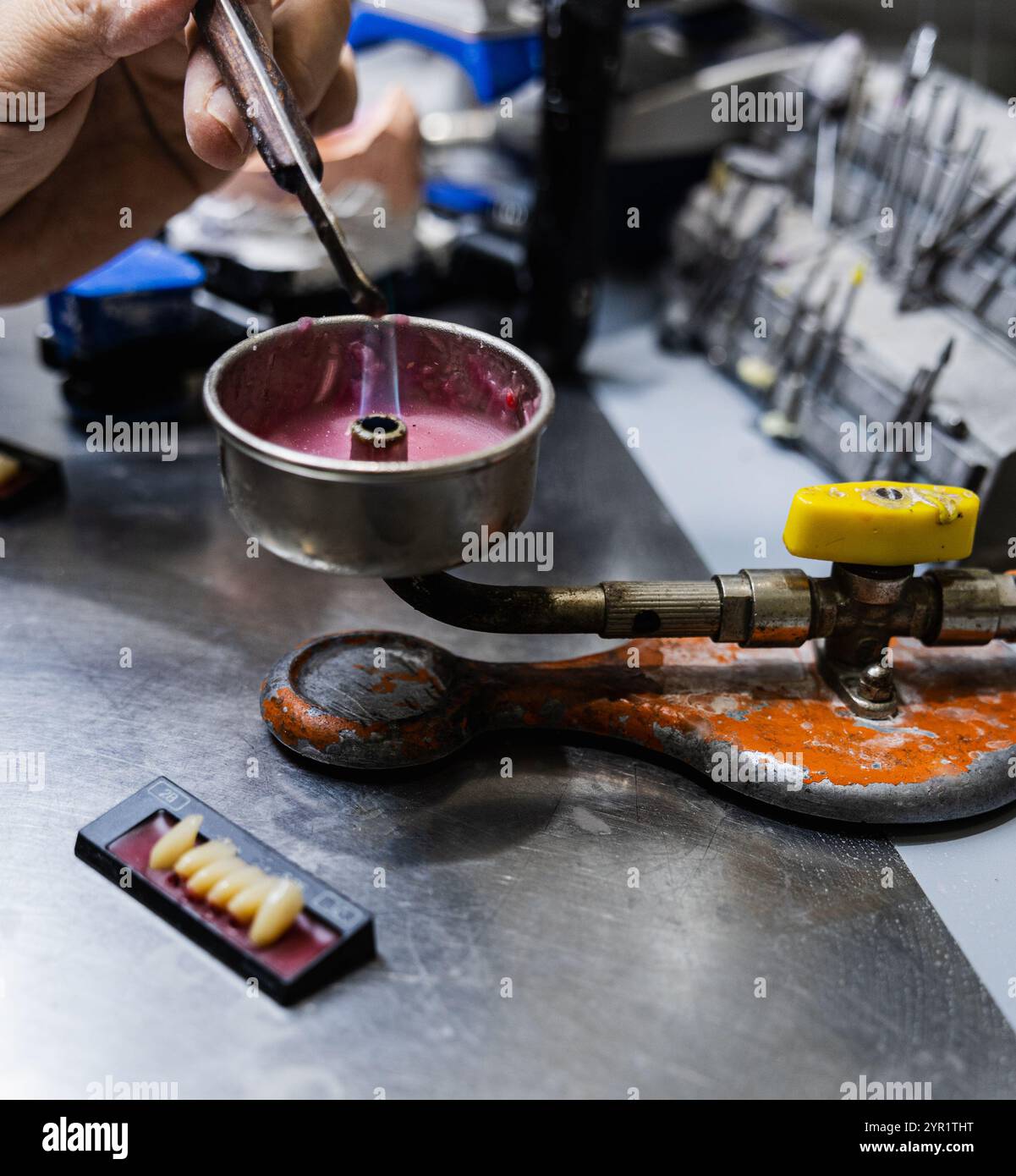 A close-up of a dental technician melting wax for dental prosthetics ...