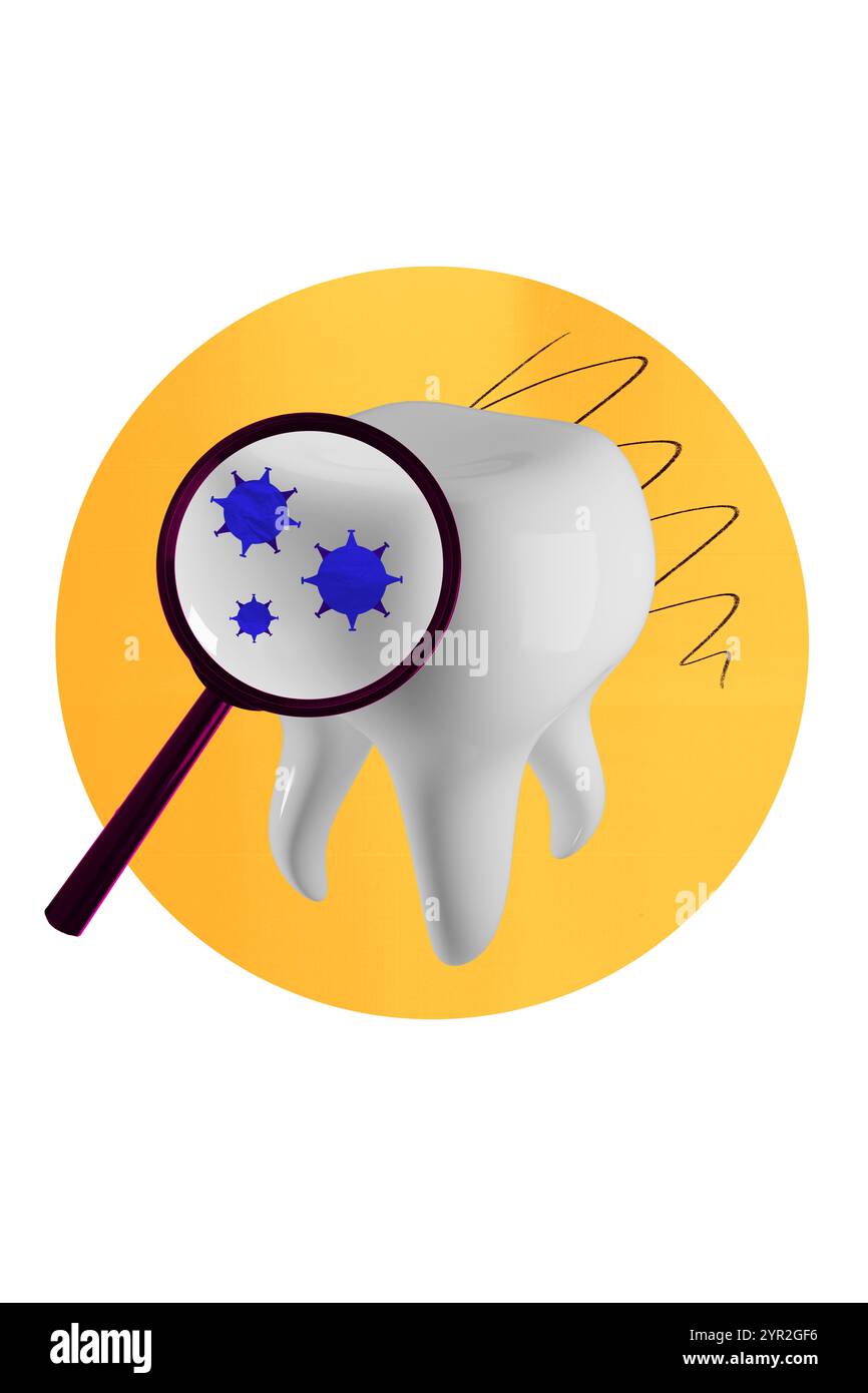 Contemporary art collage. Tooth magnified by lens revealing bacteria ...