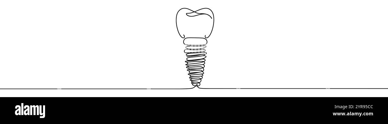 One continuous line illustration of dental implant, isolated on white ...