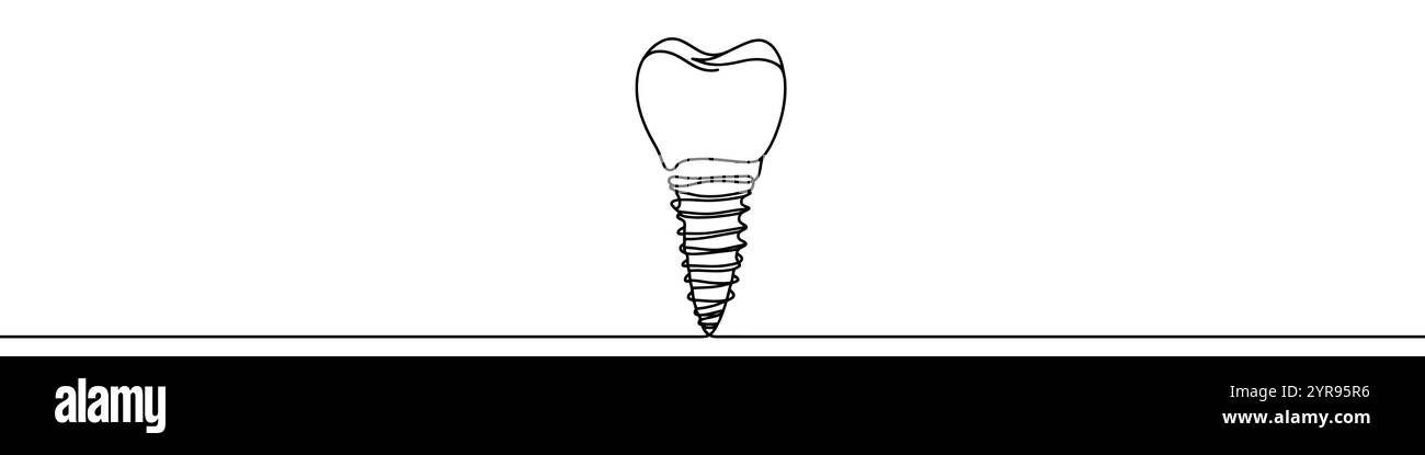 One continuous line illustration of dental implant, isolated on white ...