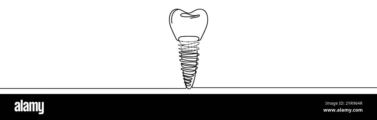 One continuous line illustration of dental implant, isolated on white ...