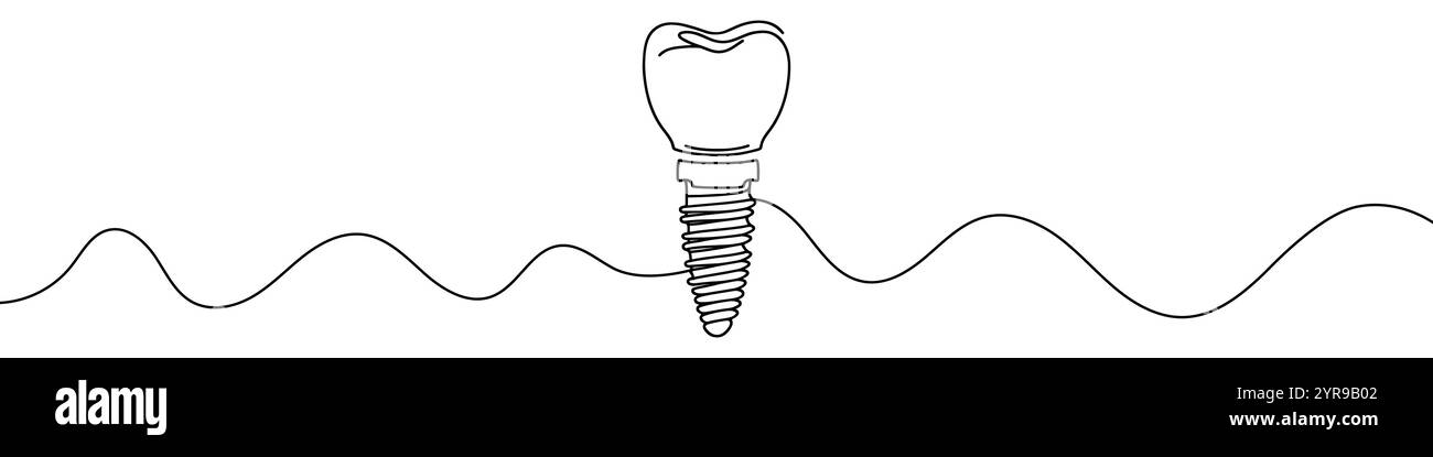 One continuous line illustration of dental implant, isolated on white ...