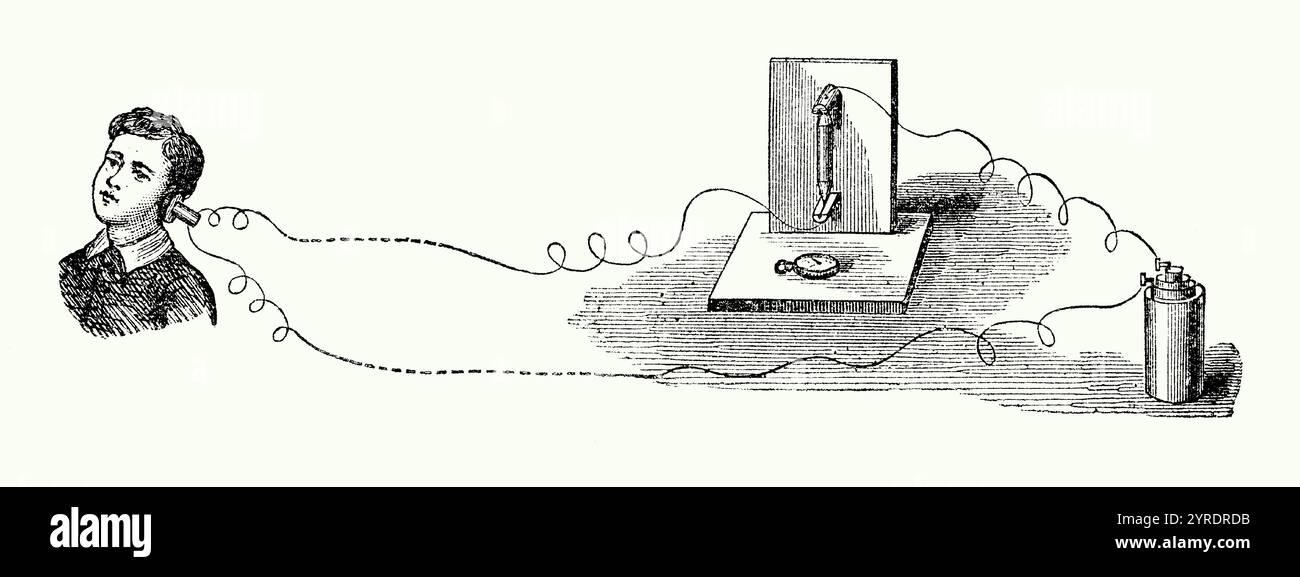 An old engraving of an early home-made microphone of the late 1800s. It ...
