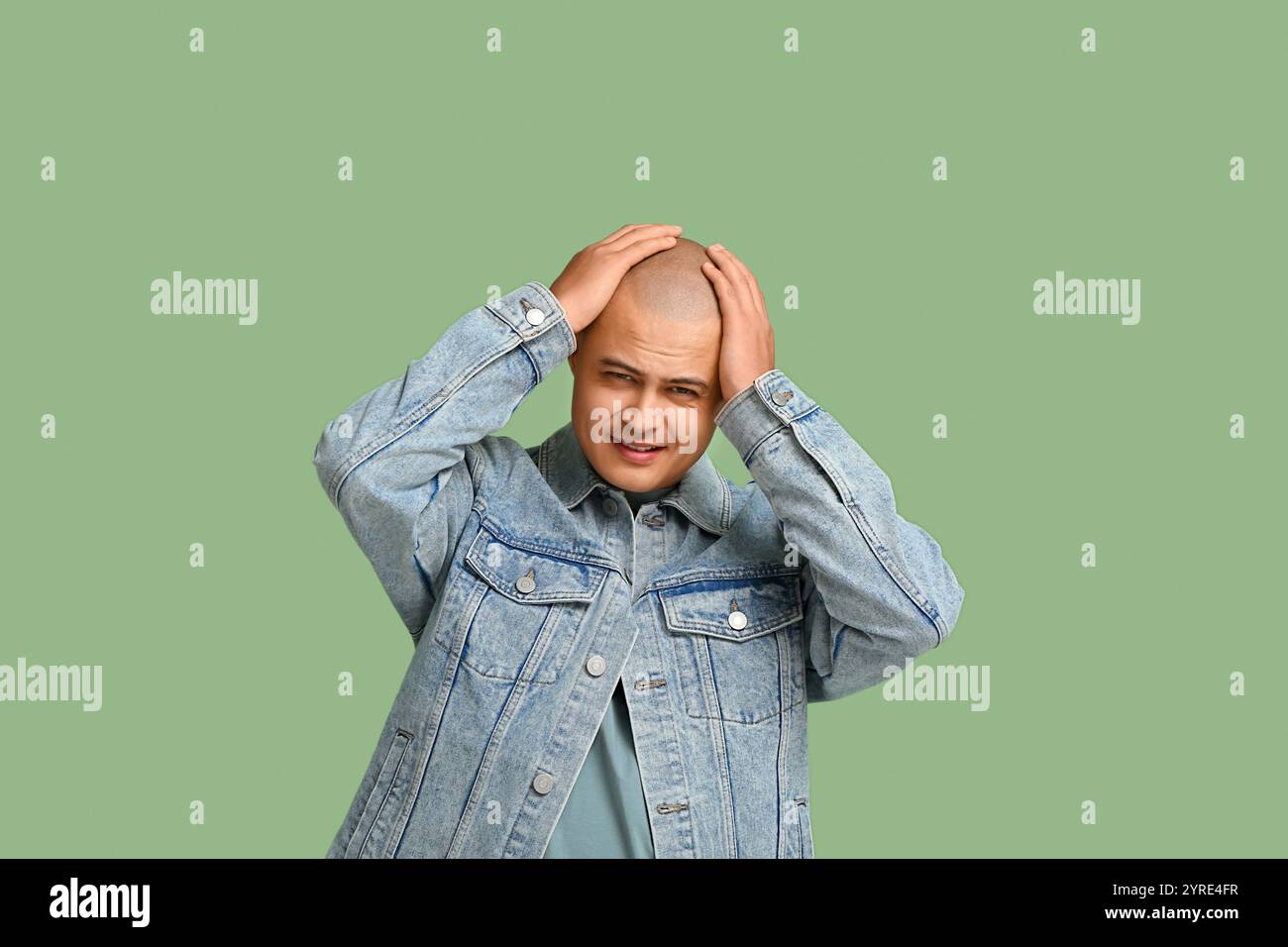 Stressed bald young man hi-res stock photography and images - Alamy