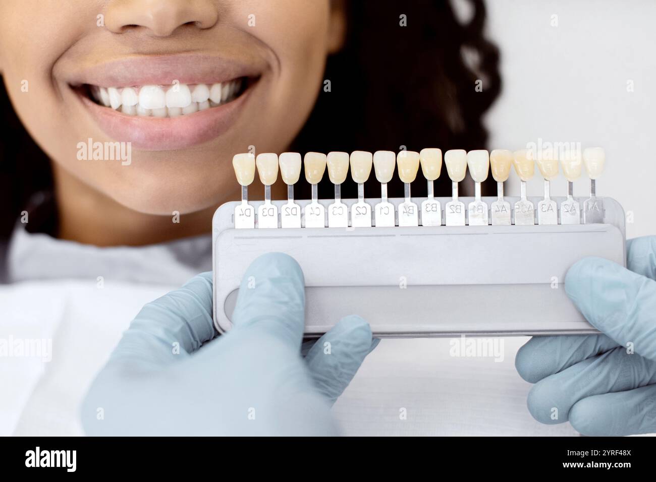 Stomatologist Holding Dental Teeth Shade Guide Chart Choosing Color For ...