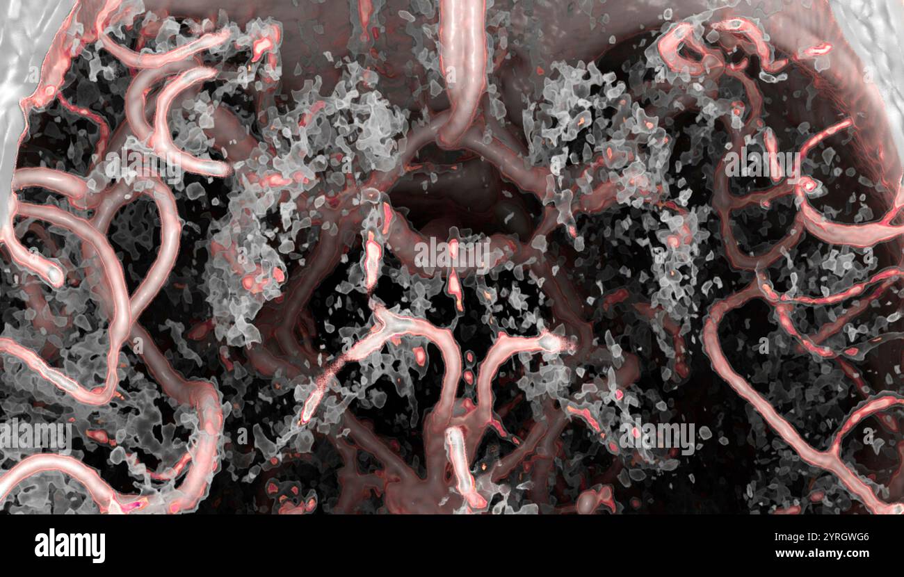 Magnetic resonance imaging (MRI) angiogram of a section through the ...