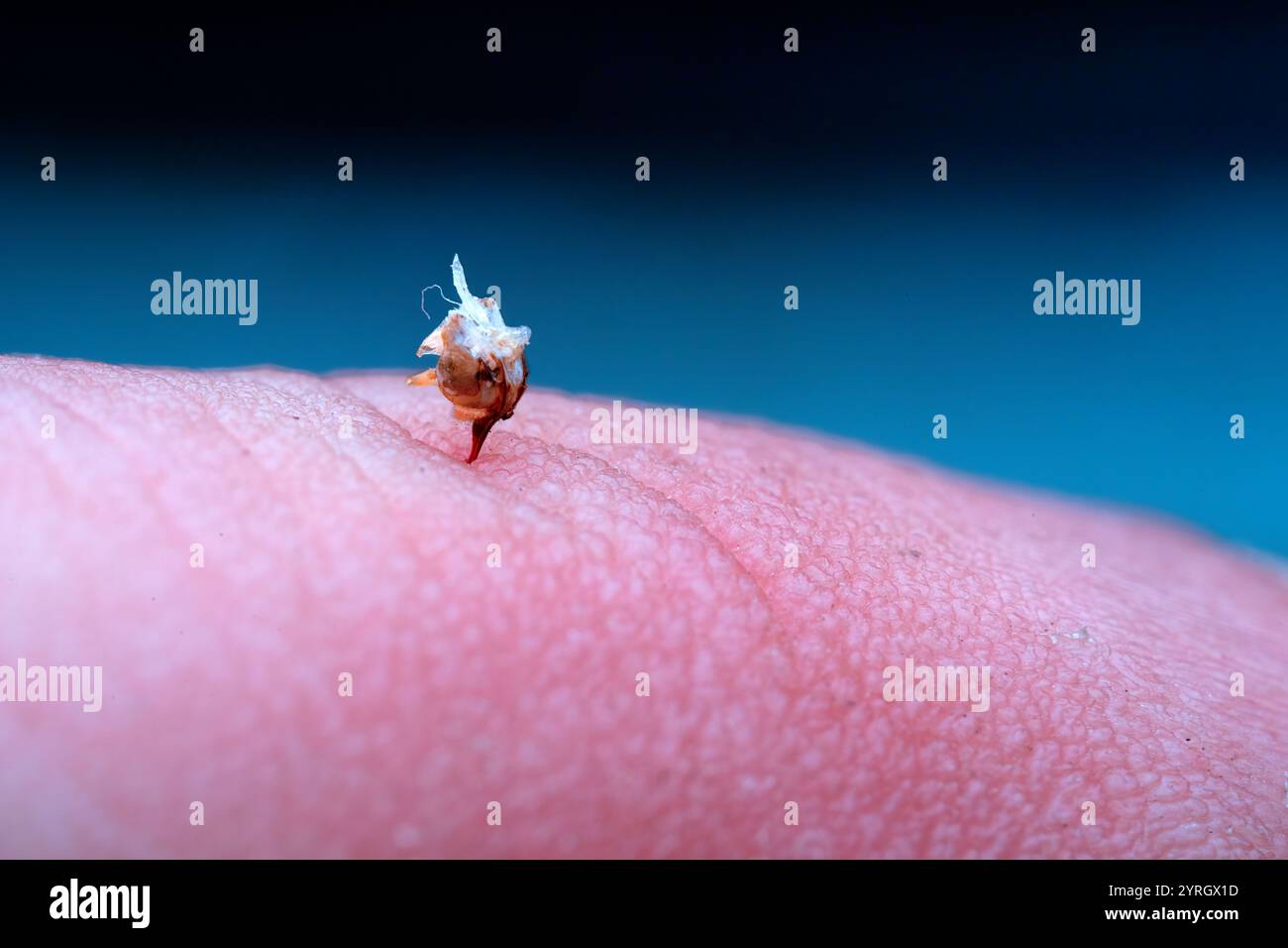 Stinging barb, venom sac and accompanying muscles from a bee ...