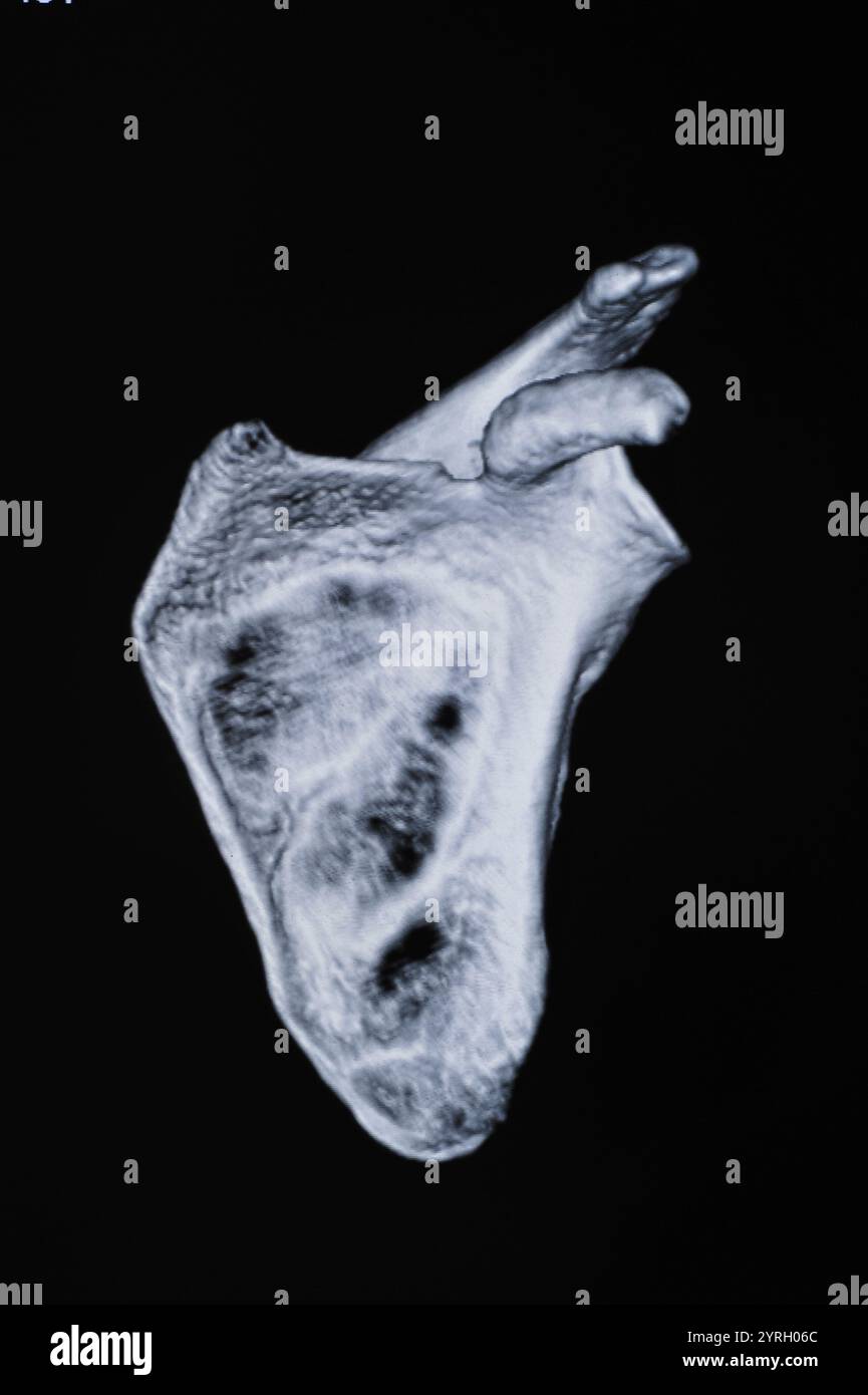 Human bone CT images Stock Photo - Alamy