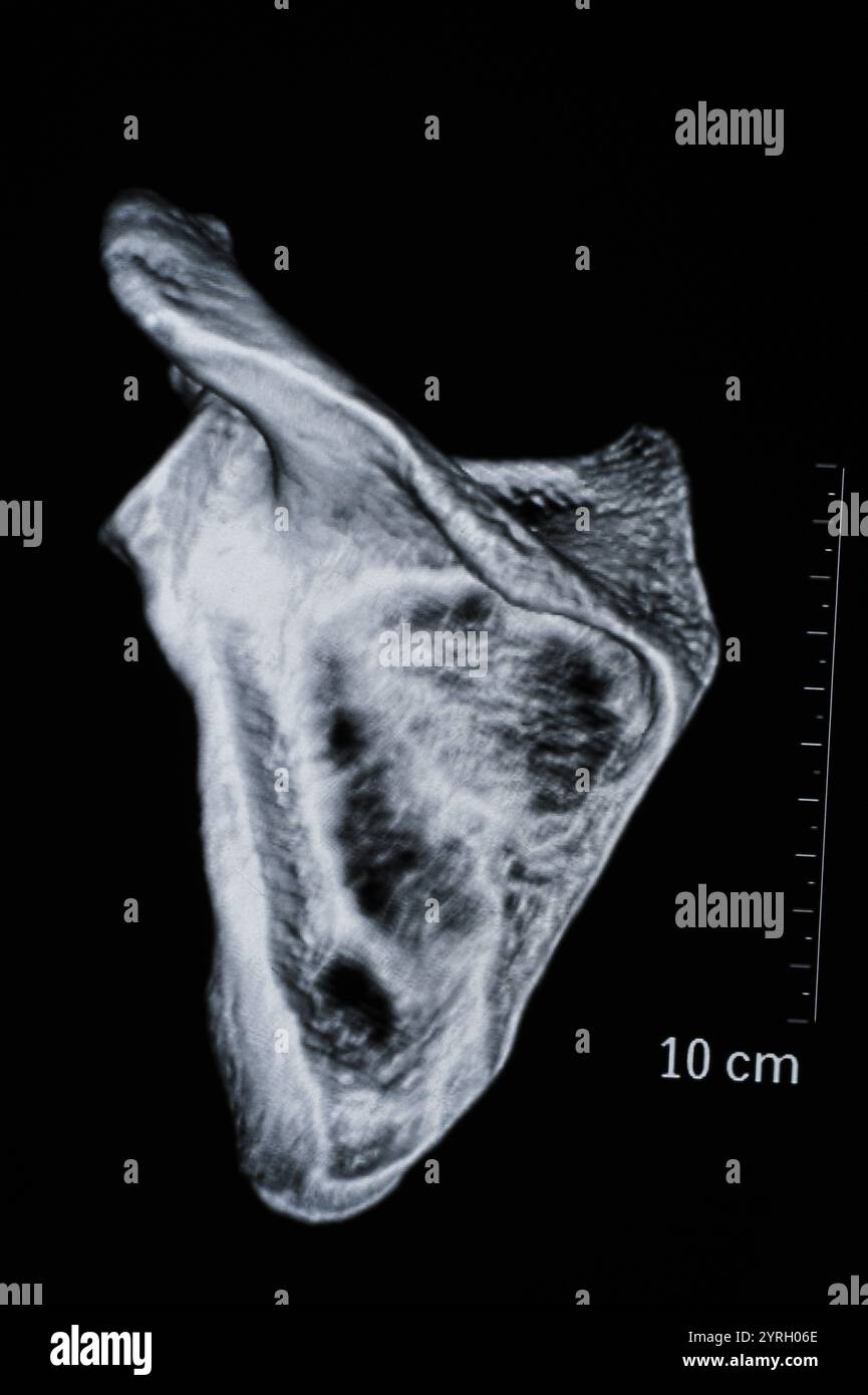 Human bone CT images Stock Photo - Alamy