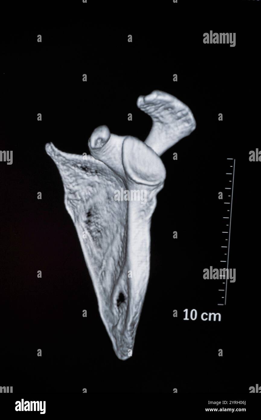 Human bone CT images Stock Photo - Alamy