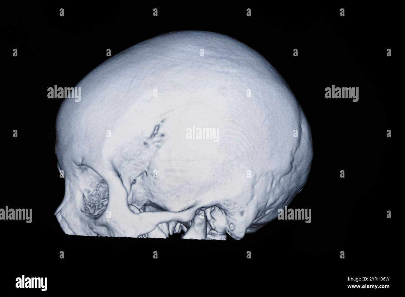 Human skull CT scans Stock Photo - Alamy