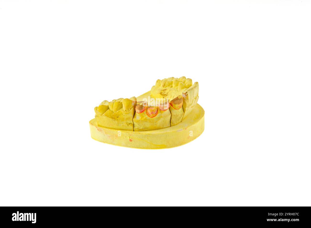The tooth mold Stock Photo - Alamy