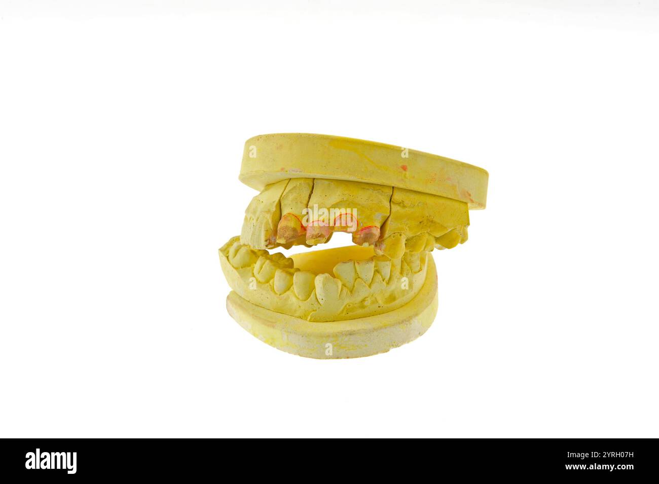 The tooth mold Stock Photo - Alamy