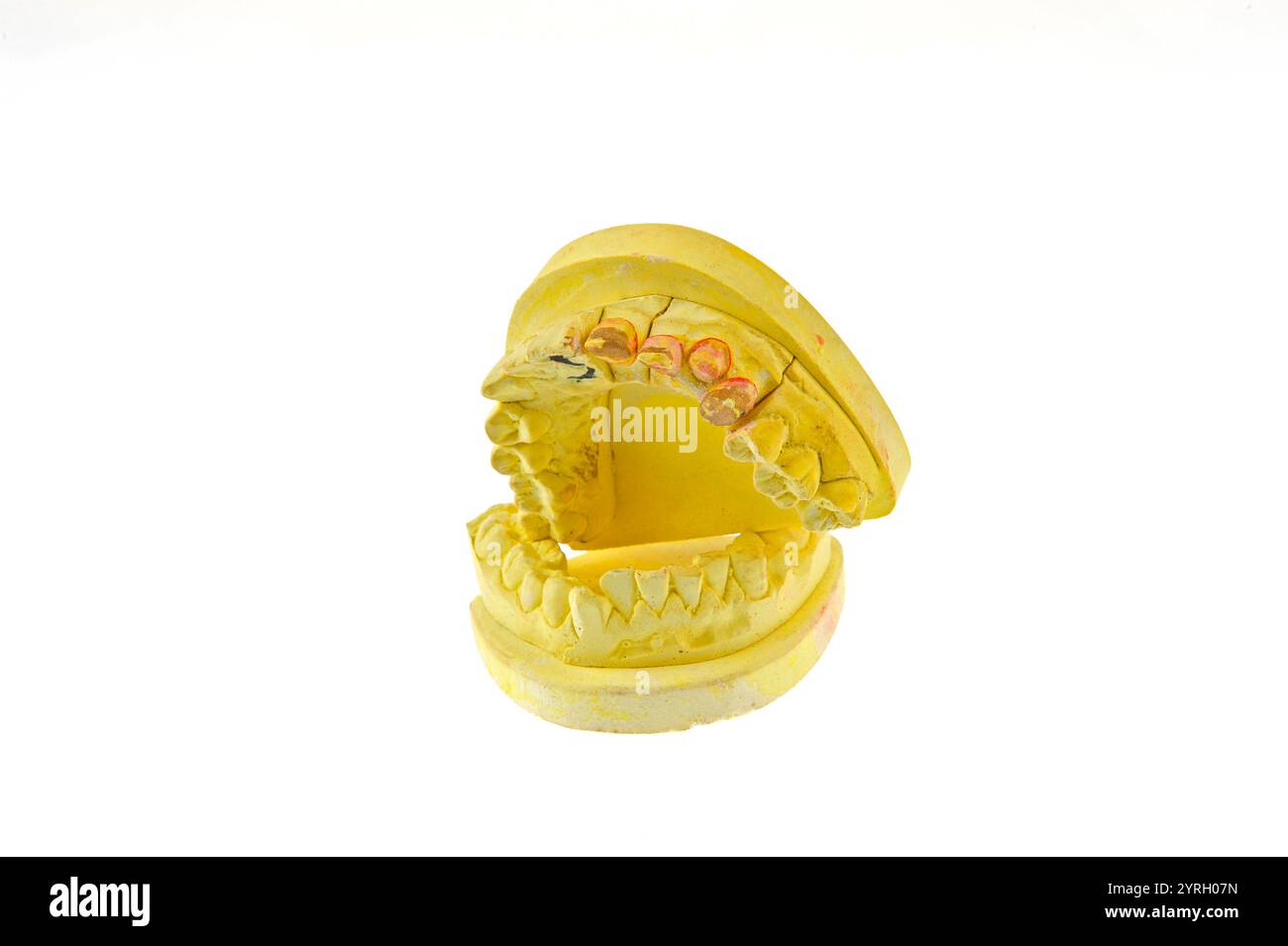 False tooth Cut Out Stock Images & Pictures - Alamy