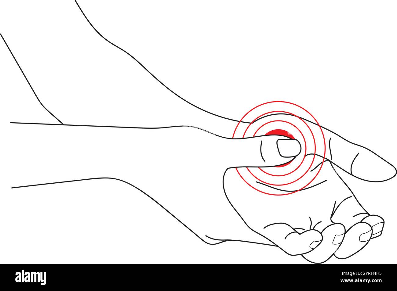 Acupuncture points on hand, Human anatomy Stock Vector Image & Art - Alamy