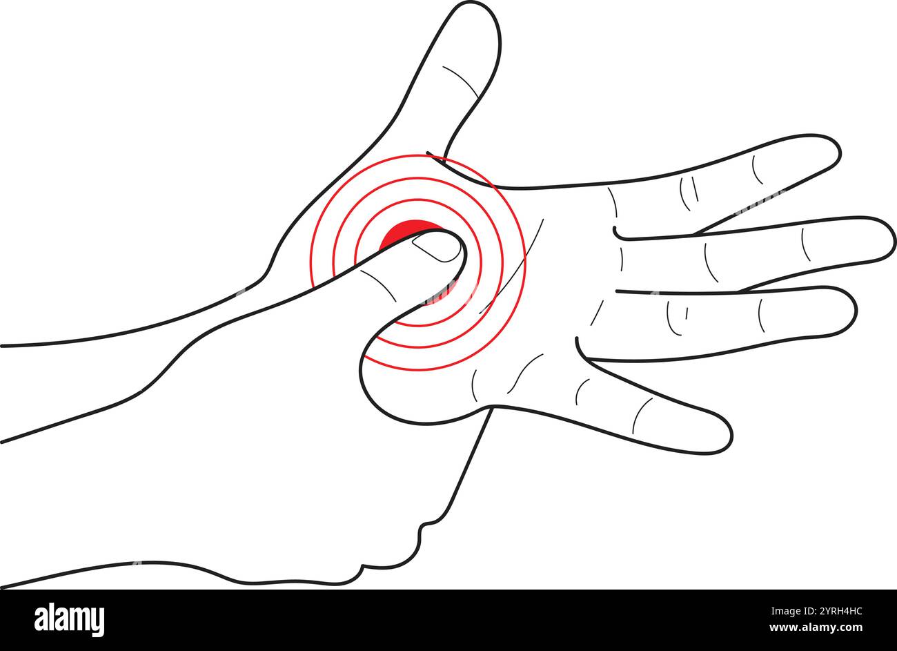 Acupuncture points on hand, Human anatomy Stock Vector Image & Art - Alamy