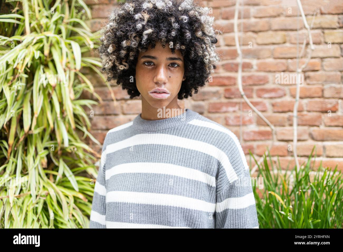 A mixed race woman with vitiligo, wearing a striped sweater, poses by a ...