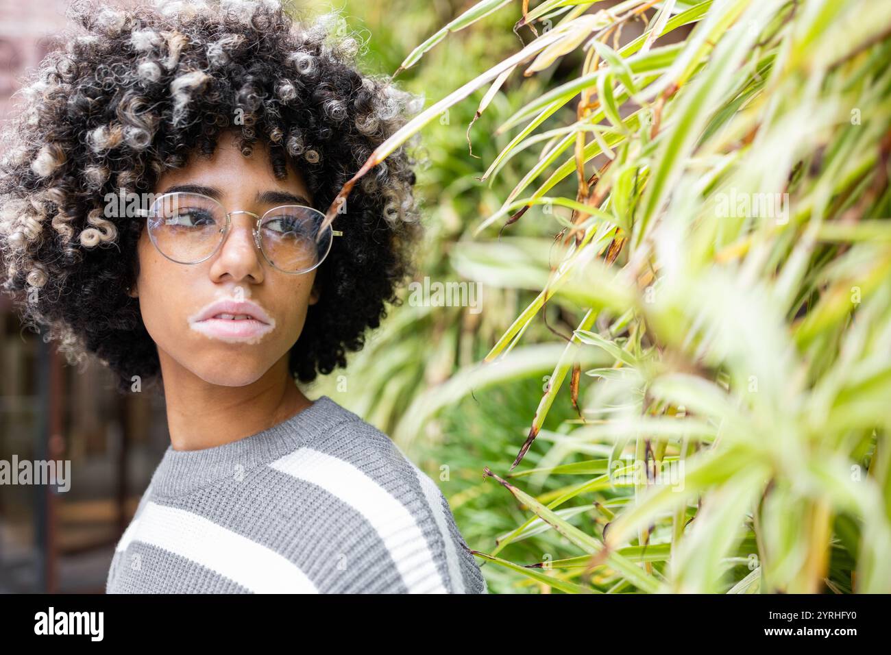 A mixed race woman with vitiligo enjoys a relaxing day at the ...