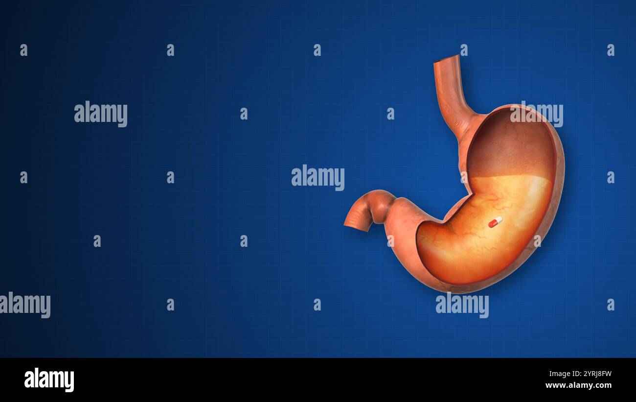 Acid Relief with Antacid in Stomach Stock Photo - Alamy
