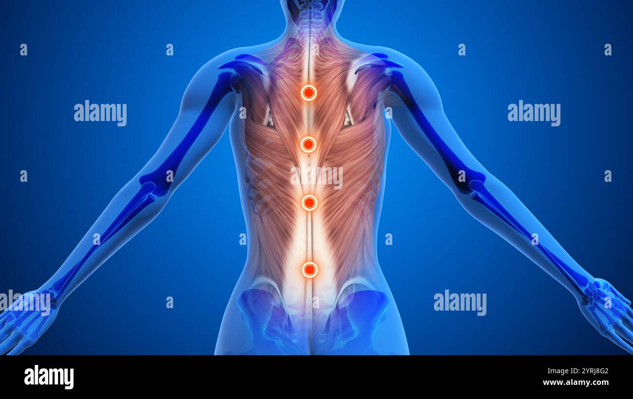 Highlighted Acupressure Points for Back Relief Stock Photo - Alamy