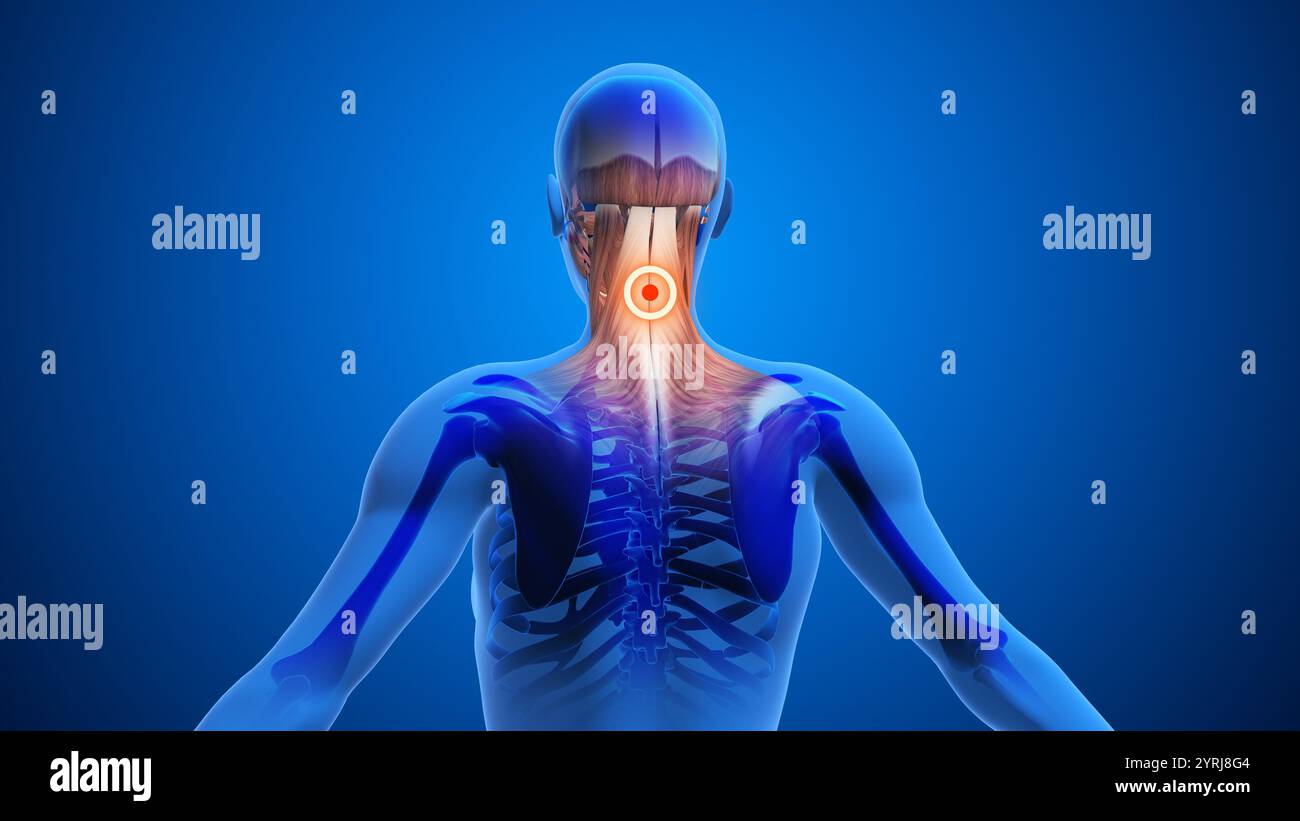 Highlighted Pressure Points for Neck Relief Stock Photo - Alamy