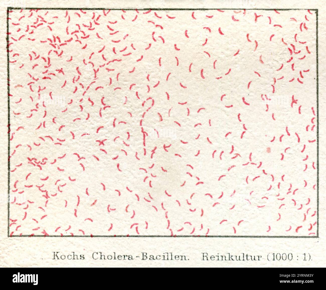 Cook cholera bacteria under the microscope (1000: 1). , (encyclopedia ...