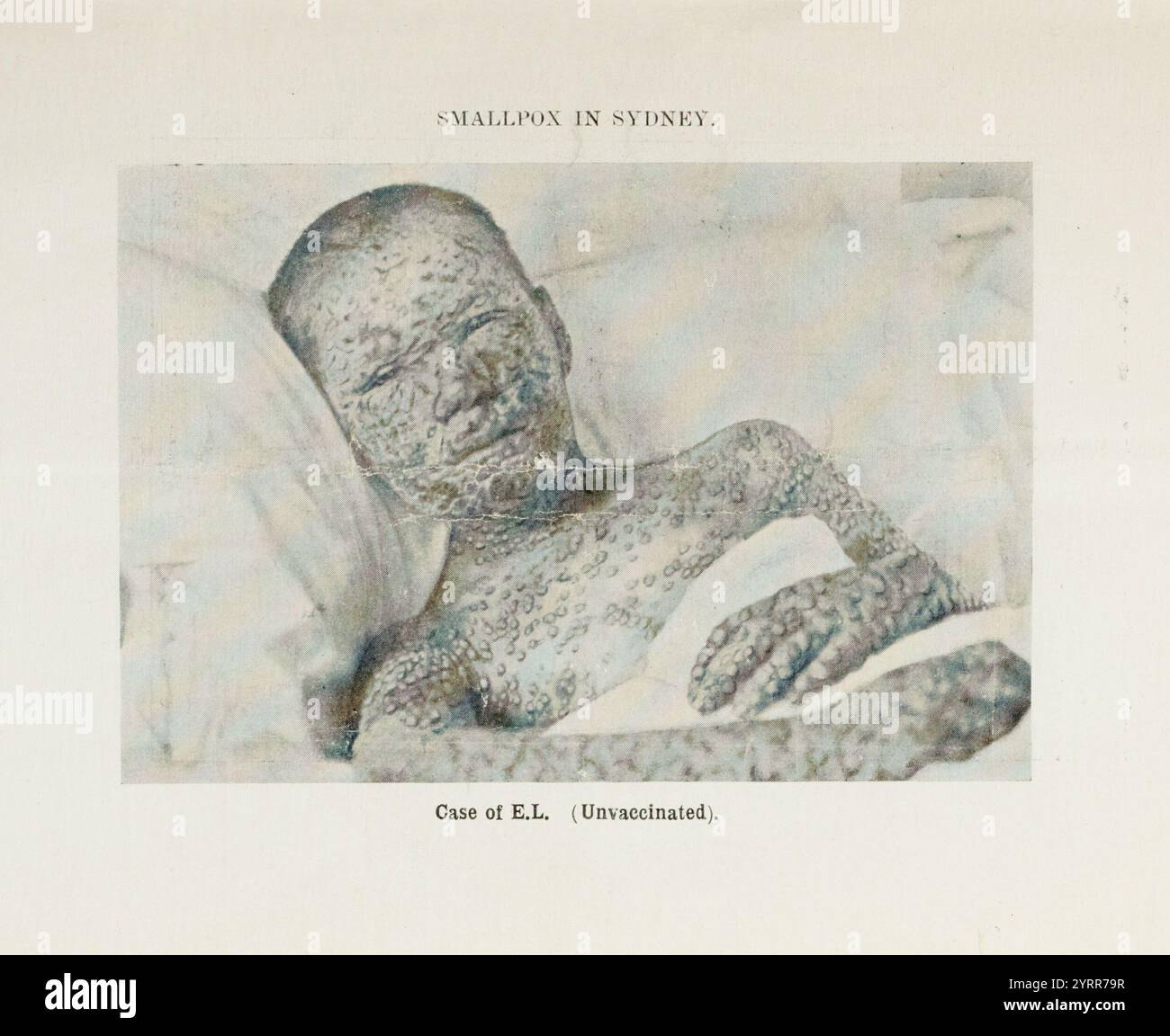 Child vaccination australia hi-res stock photography and images - Alamy