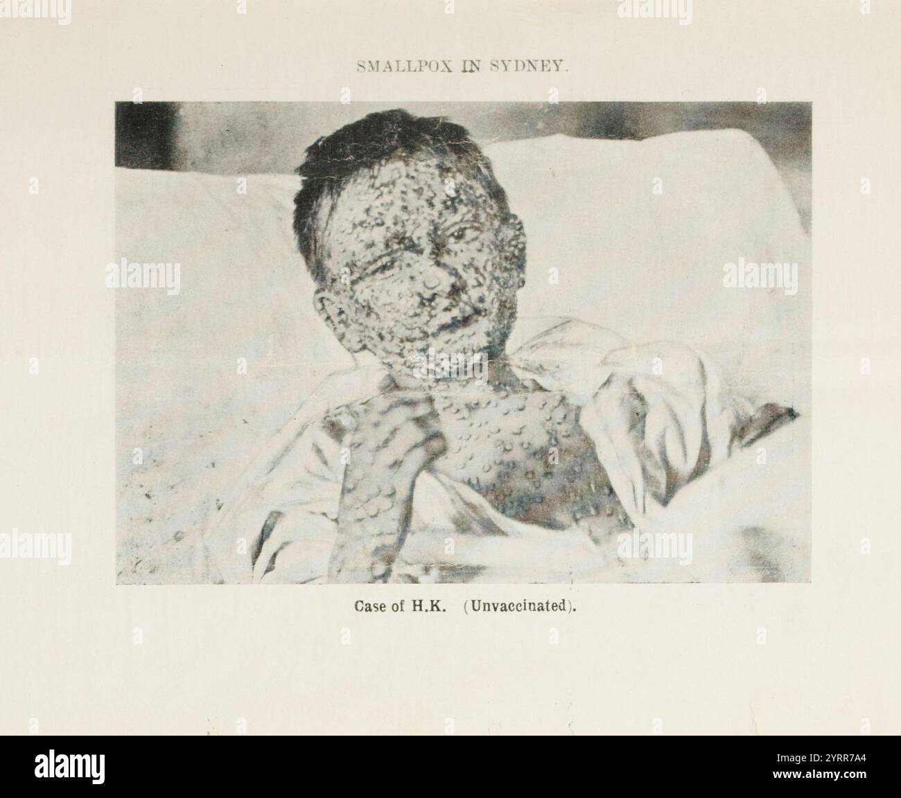 Child vaccination australia hi-res stock photography and images - Alamy