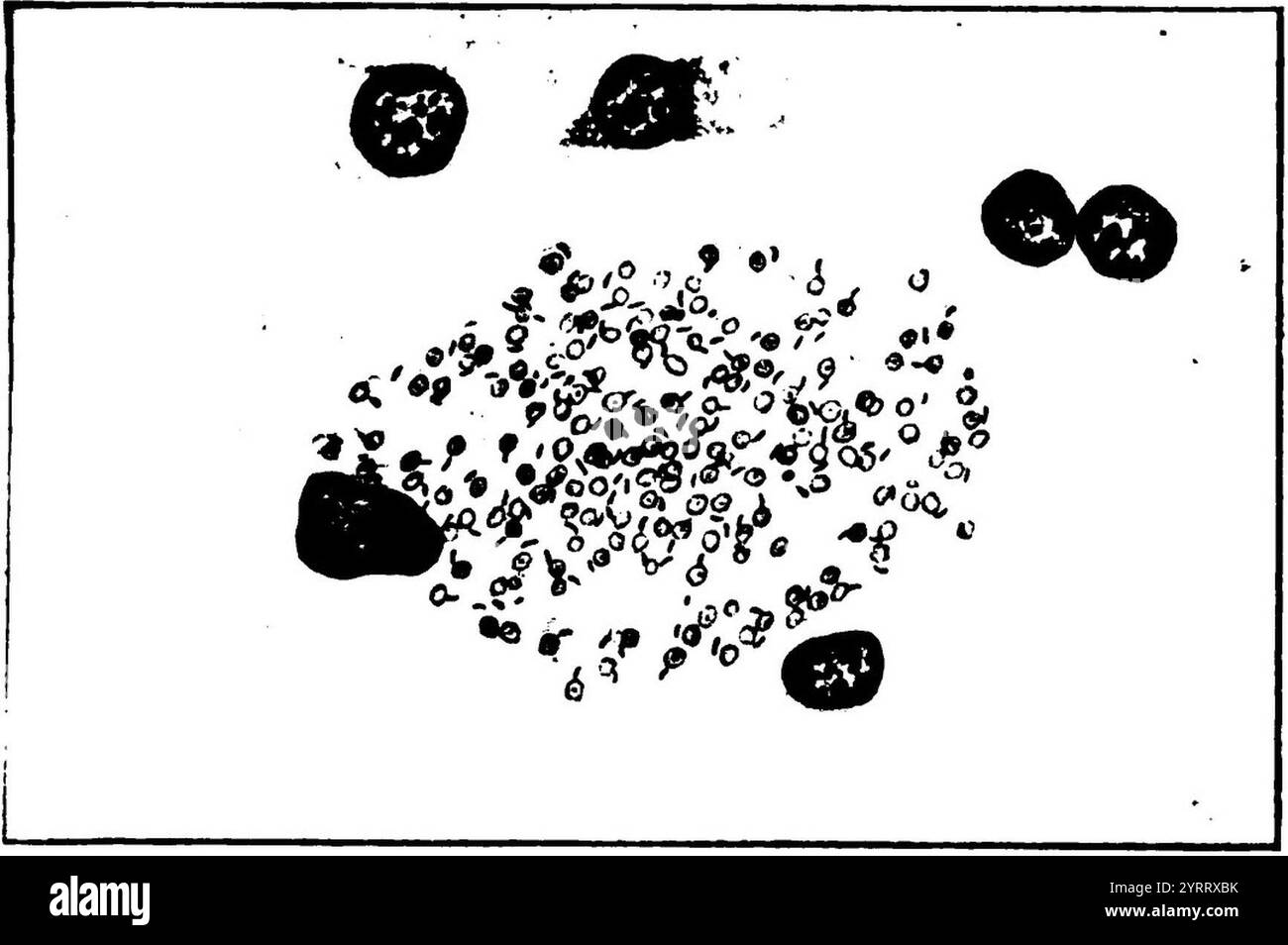 Chagas Cut Out Stock Images & Pictures - Alamy