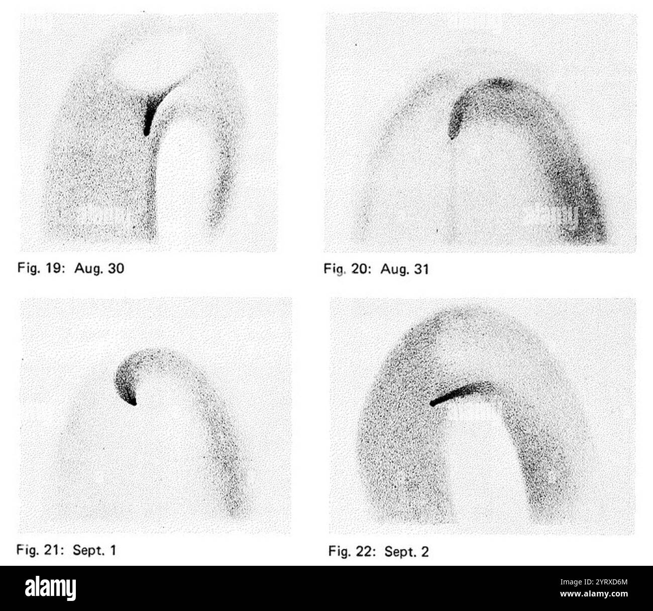 Comet swift tuttle hi-res stock photography and images - Alamy