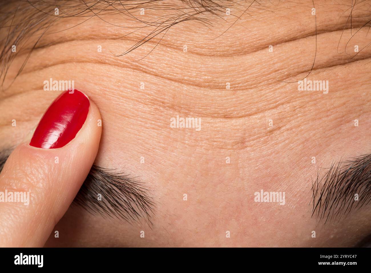 Close-up of woman's forehead showing wrinkles and aging skin, touching ...