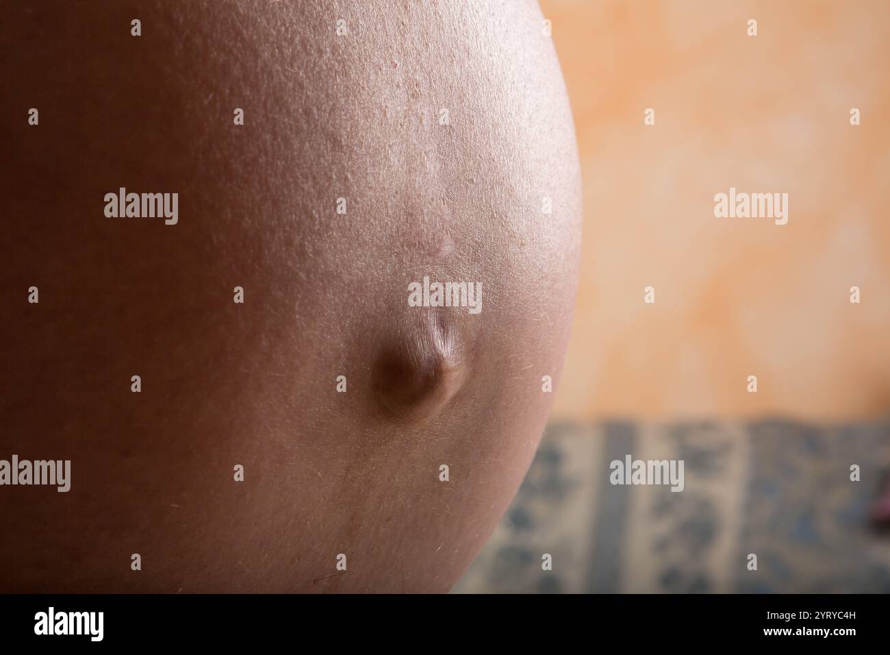 Close-up of a pregnant belly highlighting the protruding navel and skin ...